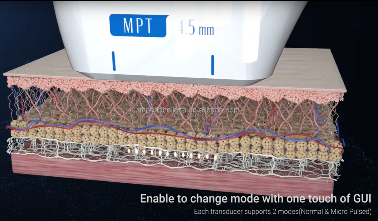 Latest HIFU Technology Ultraformer MPT MMFU 7D Ultraformer IV Face and ...