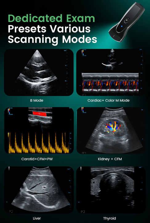Yonker Pediatric Physical Exam Handheld Ultrasound Device Evaluate ...