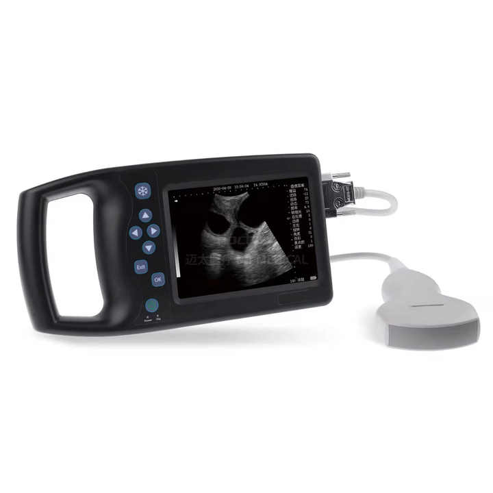 MT MEDICAL Ergonomic Handle Design Wireless Ultrasound Probe Ultrasound ...