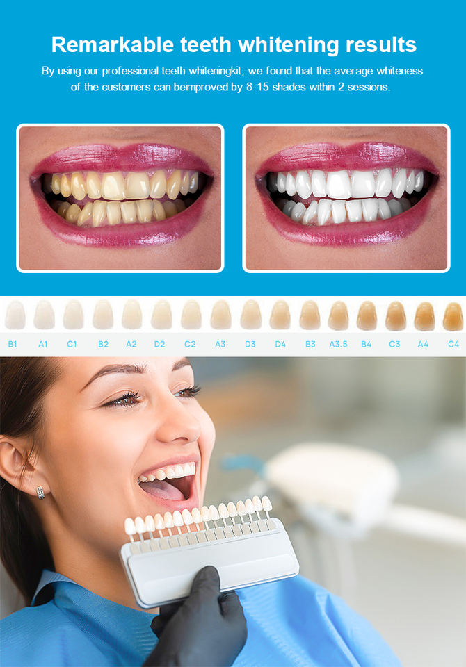 Professional Clinic-grade Oral Whitening Kit Features a 35% High ...