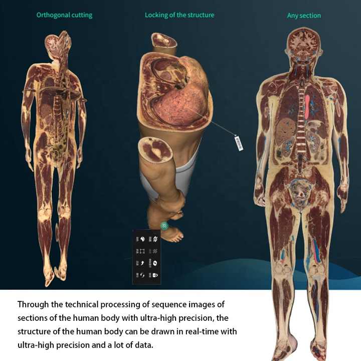 Digital Human Anatomy System - 3D Virtual Dissection Table