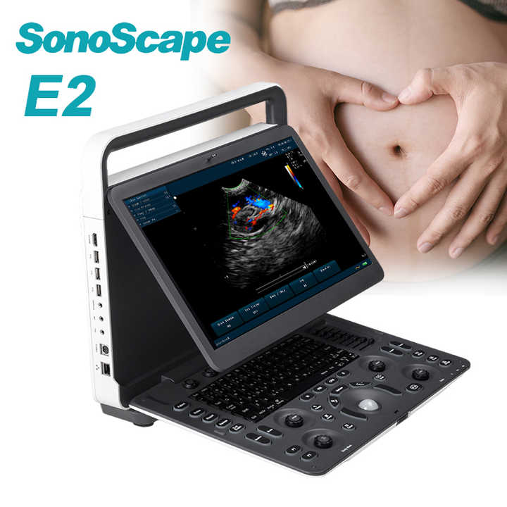 Sonoscape E2 Portable Ultrasound - High Resolution & Doppler