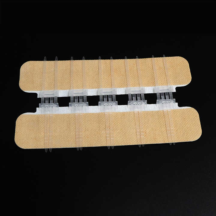 BLUENJOY Disposable Medical Zipstitch Zip Wound Skin Closure Without ...